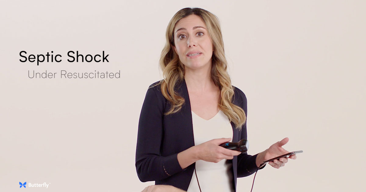 Diagnosing Sepsis – Butterfly iQ