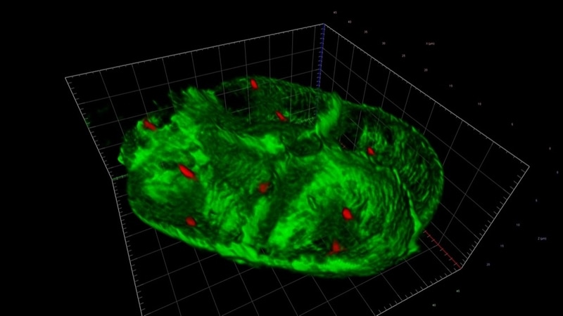 arivis Cloud - automated image analysis