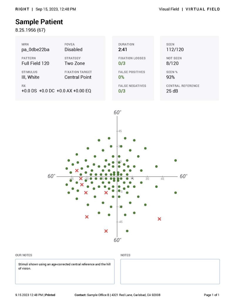 Full-Field 120 Visual Field Test | Portable VR Perimeter