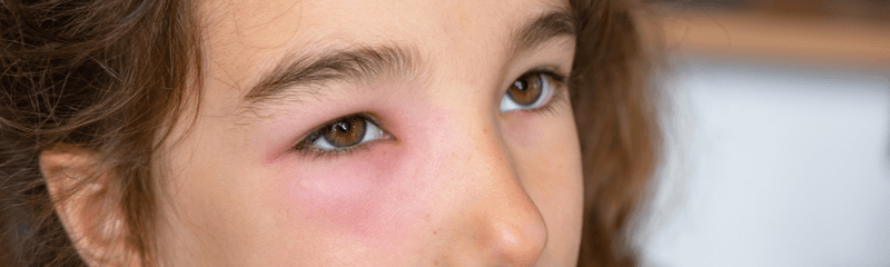 All About Sagebrush: Symptoms, Prevention, and Treatment