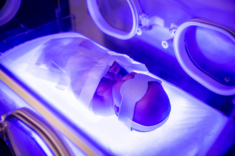 Spectral Power and Phototherapy