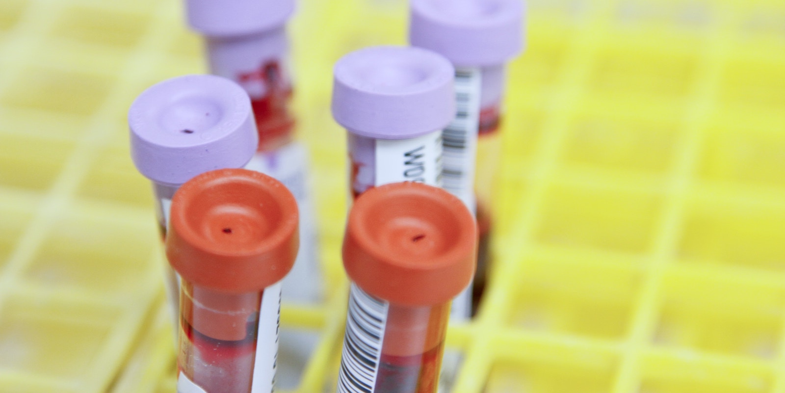 The R&D Guide: 5 Steps to Efficiently Manage & Track Your Laboratory ...