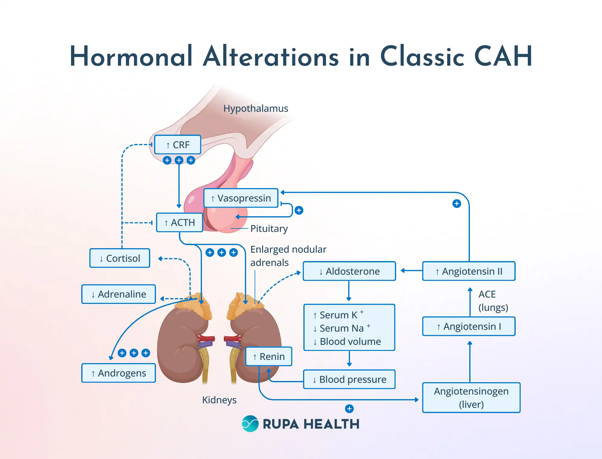What is Congenital Adrenal Hyperplasia?: Testing and Treatments