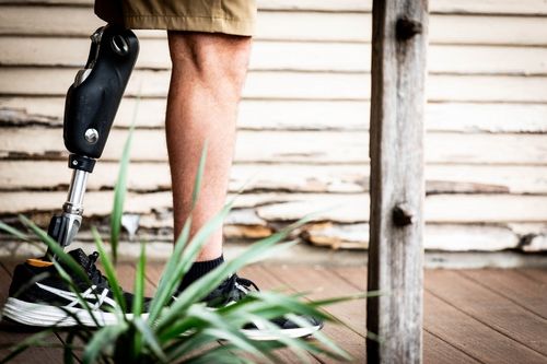 Kneuro Microprocessor Knee | BrainRobotics | Prosthetic Components