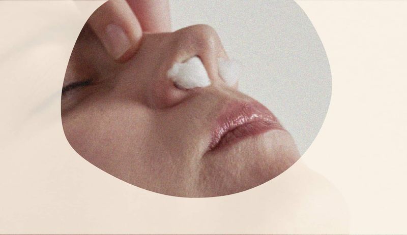 Saignements de nez (épistaxis) : causes, premiers soins et prévention