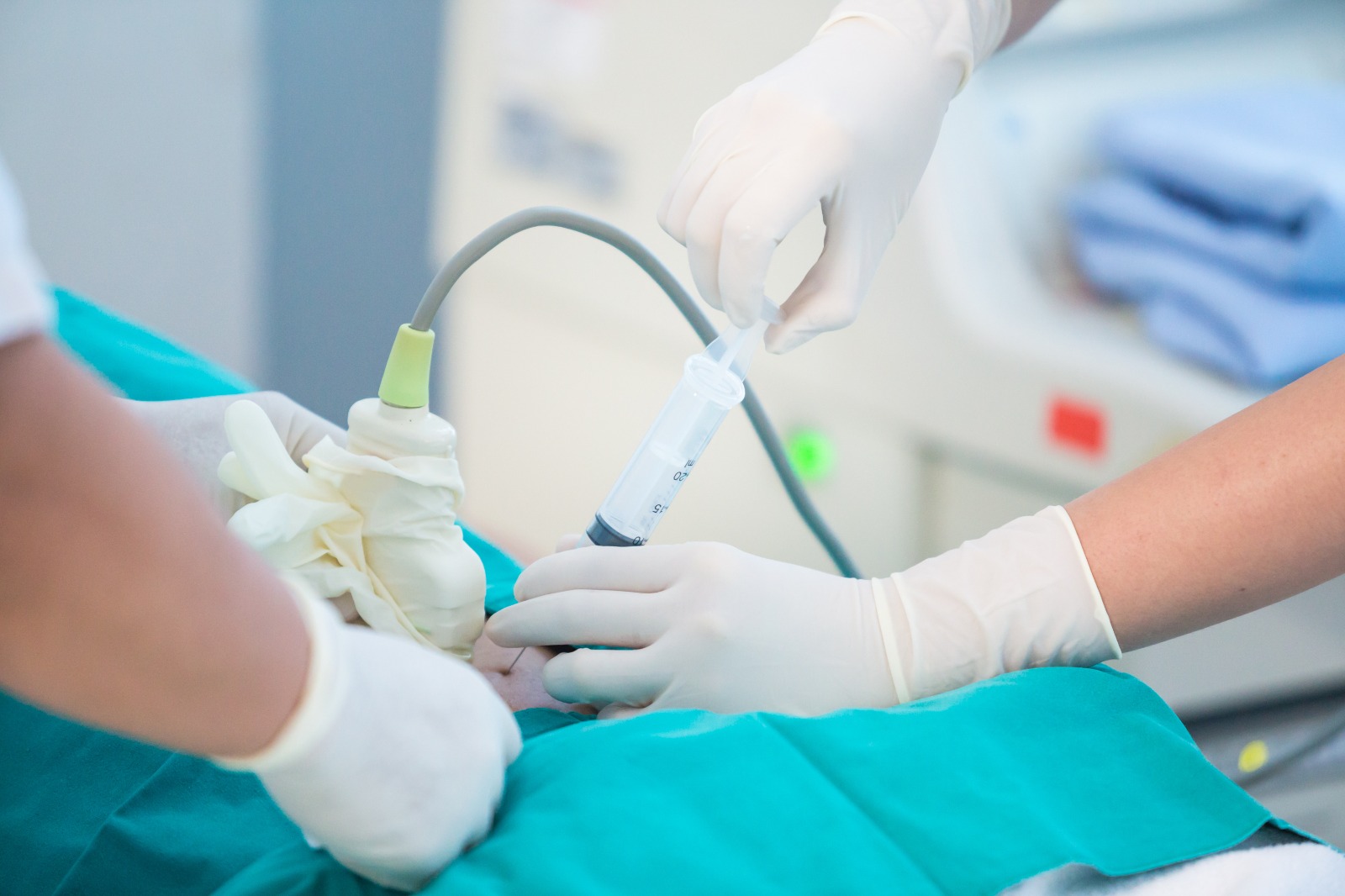 Amniocentesis: All You Want to Know