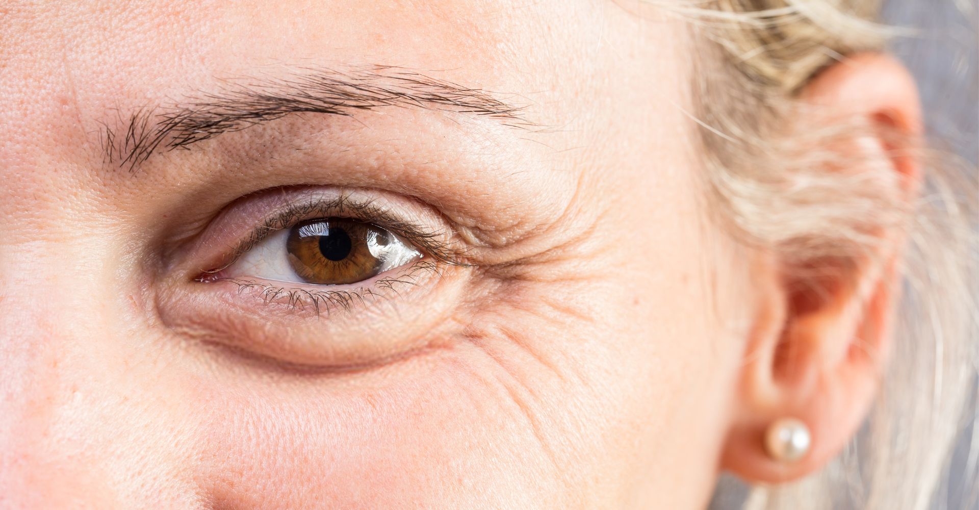 Are injectables changing the face of acting in New Zealand? | Ensemble ...