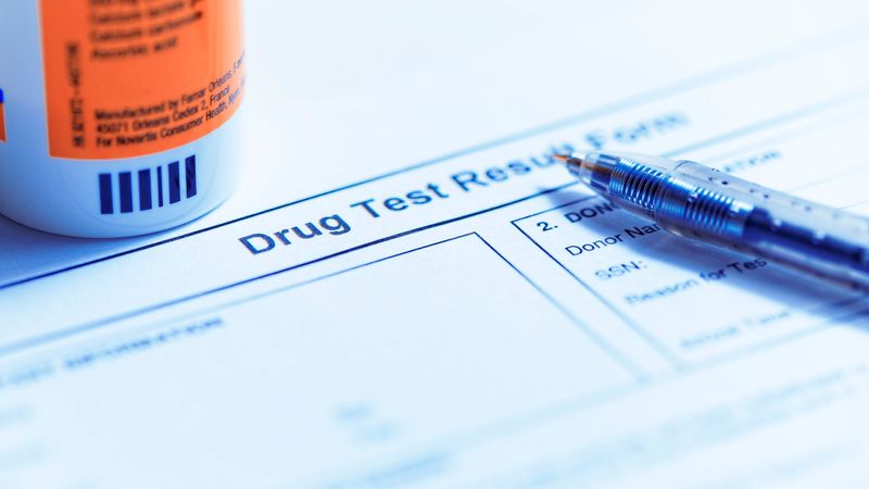 Amphetamines & Drug Testing: Detection, Timing, and codes