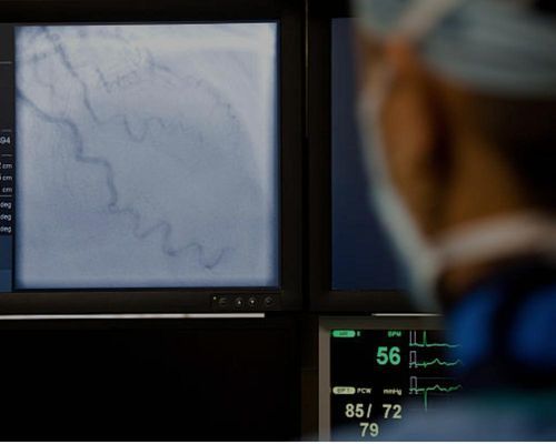 What to Expect In an Angiogram Procedure