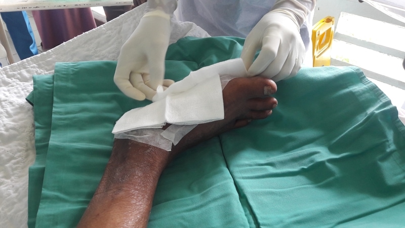 Chronic Wounds | Managing Moisture-Associated Skin Damage (MASD)