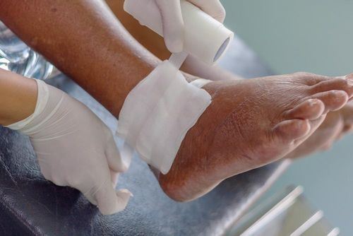 Exudate Management in Acute and Chronic Wounds