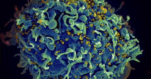 HIV breakthrough: Drug trial shows injection twice a year is 100% ...