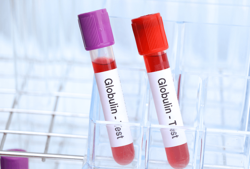 What is Globulin blood test? A complete guide • #1 Continuous Glucose ...