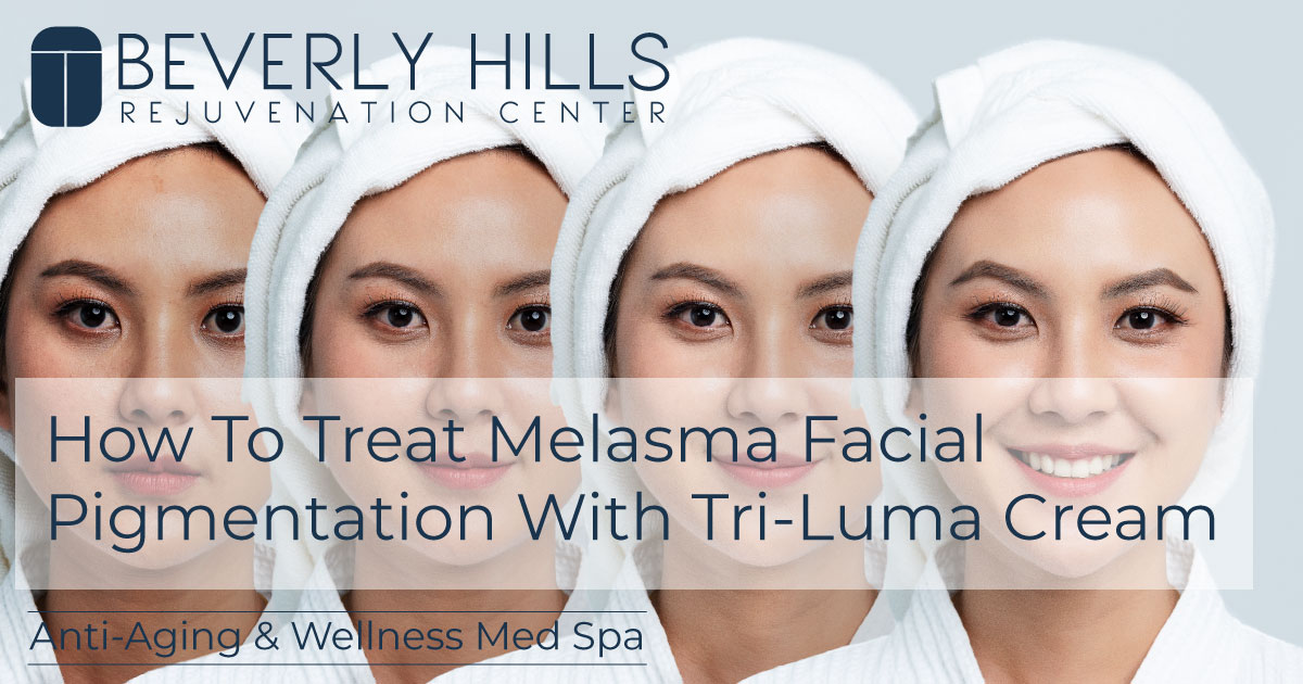 How to Treat Melasma With Tri-Luma Cream | BHRC Med Spa Blog
