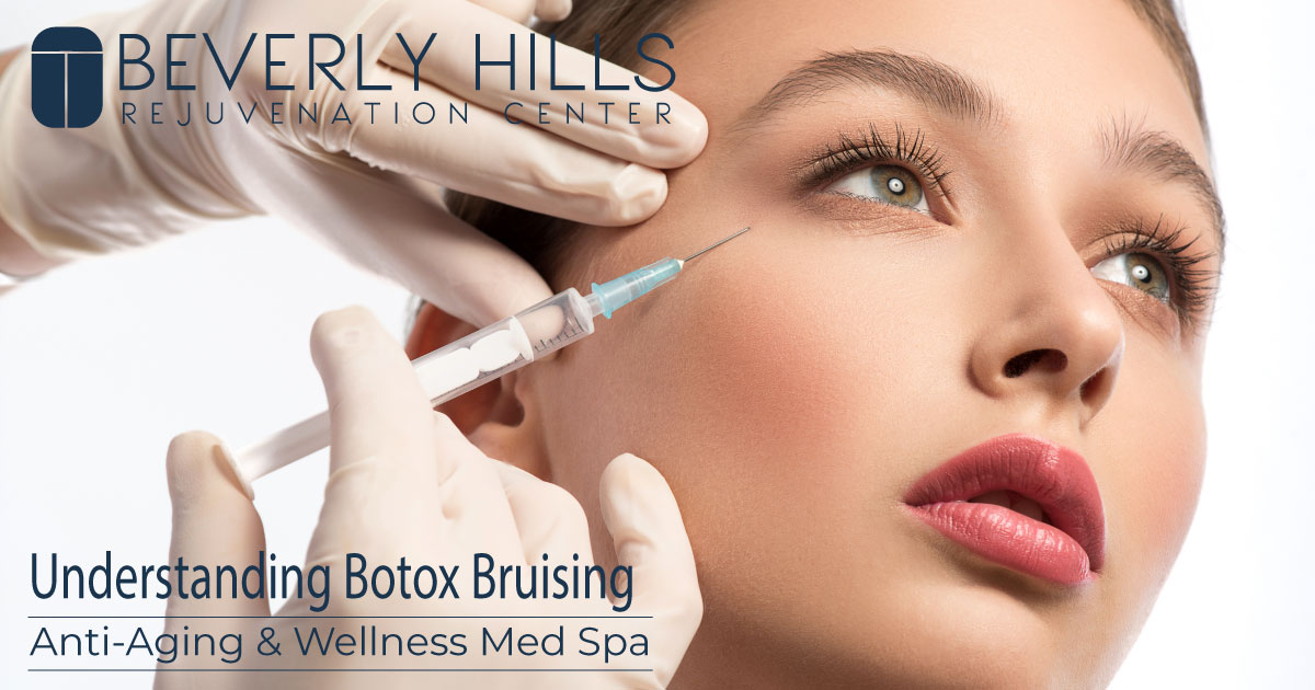 Understanding Botox Bruising | Beverly Hills Rejuvenation Center