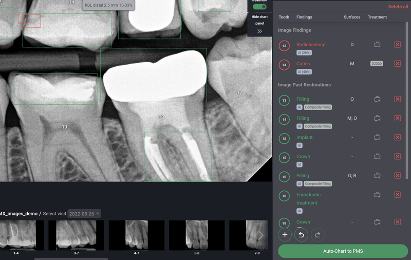 Denti.AI: AI for Dental X-Ray Imaging and Voice Charting