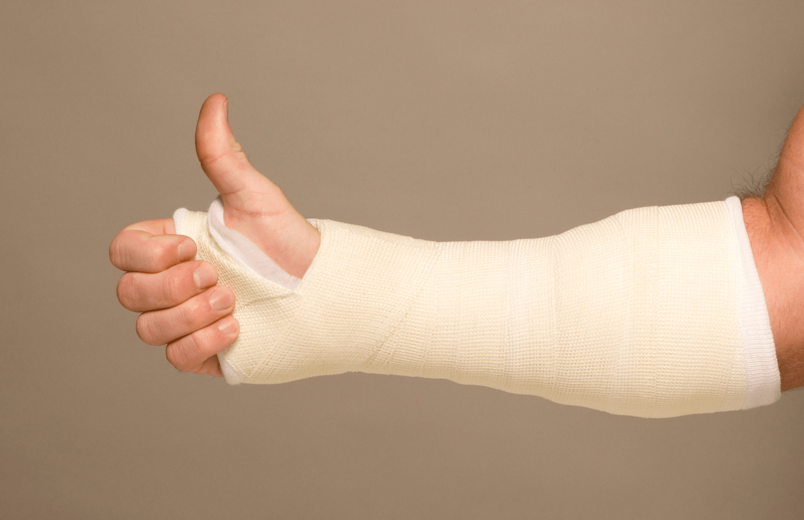 Serial Casting: What It Is & How It Helps Muscular Conditions