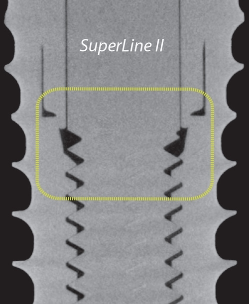 SuperLine Implants
