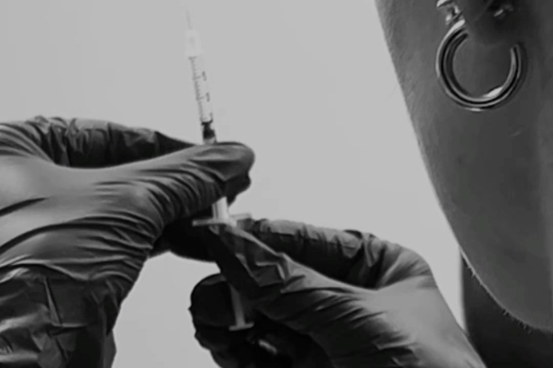 Sculptra® Biostimulator Injectable