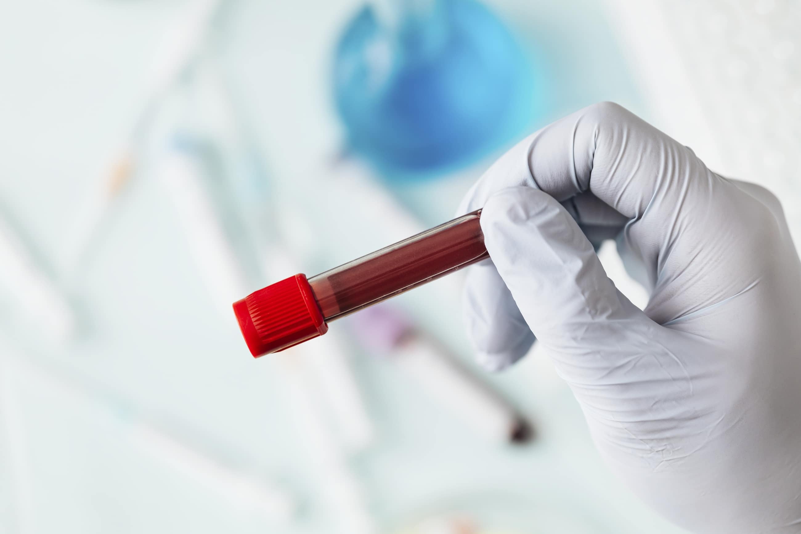 Southern Cross Diagnostics | Specialising in human diagnostics