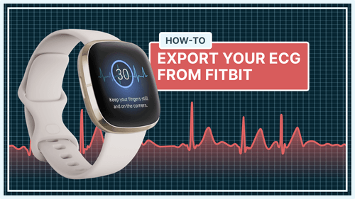 How to Export Your ECG from Fitbit | Qaly