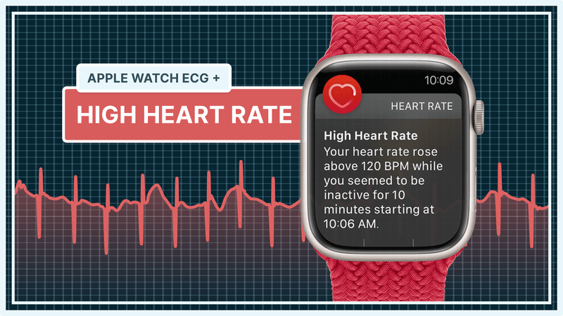 Qaly | How To Read Your ECG