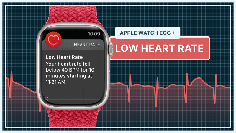 What Low Heart Rate Means on Your Apple Watch ECG | Qaly