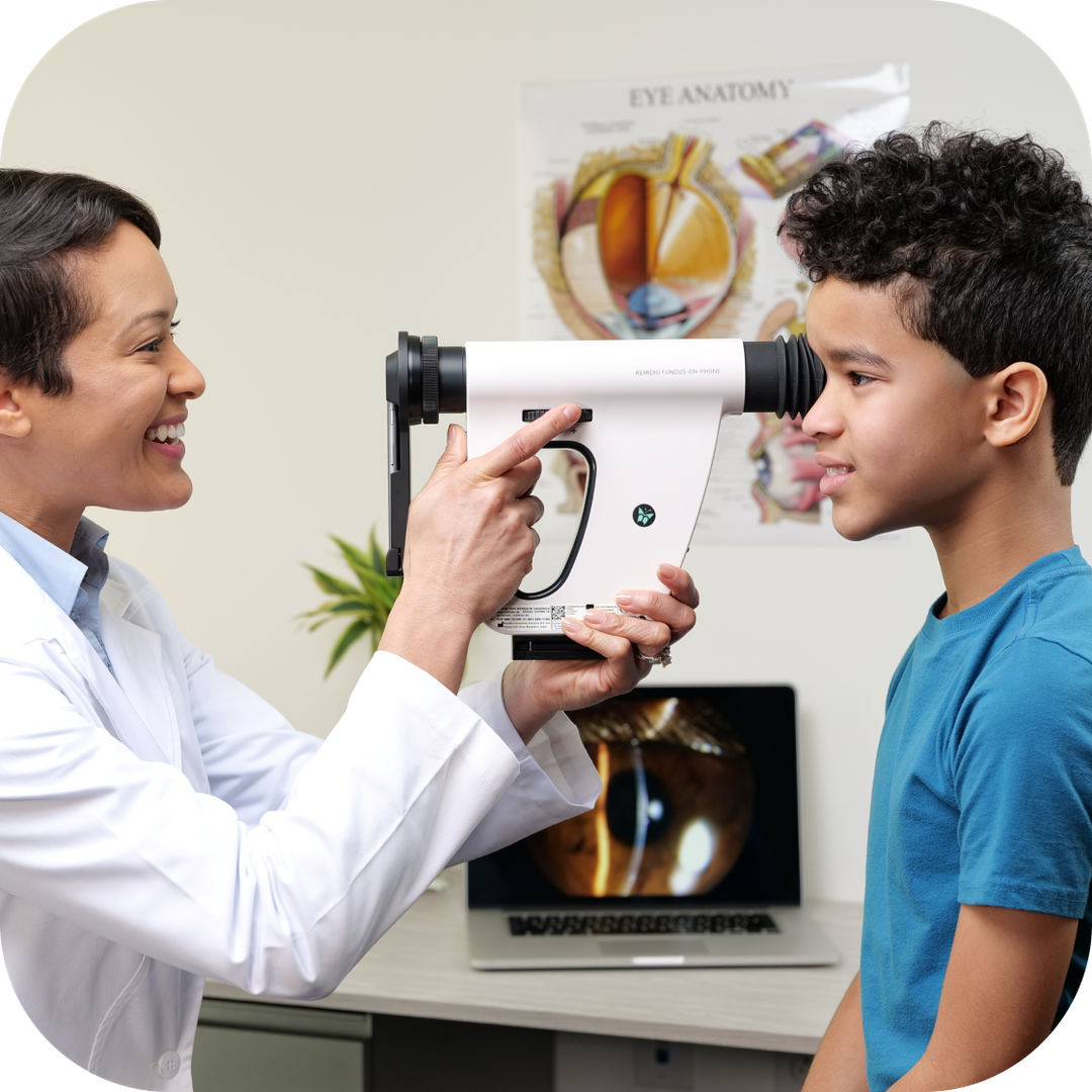 Remidio FOP NM-10 | Non Mydriatic Hand Held Fundus Camera