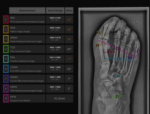 ImageBiopsy Lab - Automated MSK Imaging