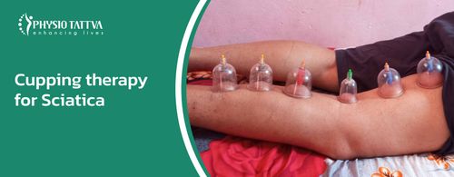 Relieving Sciatica Pain with Cupping Therapy