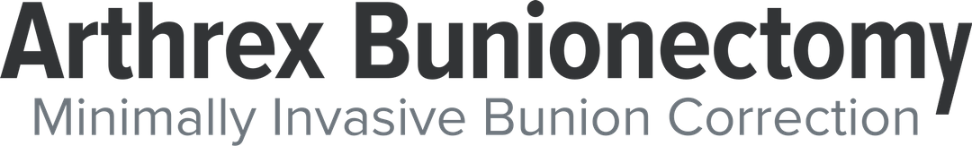 Arthrex Bunionectomy | Minimally Invasive Bunion Correction