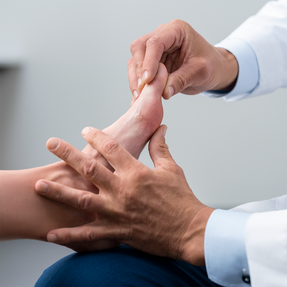 Arthrex Bunionectomy | Minimally Invasive Bunion Correction
