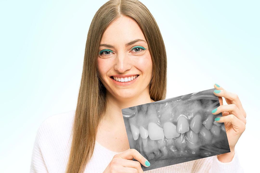 Rentgen zubů: Klíčová pomoc pro zdravý chrup | Svět rovnátek