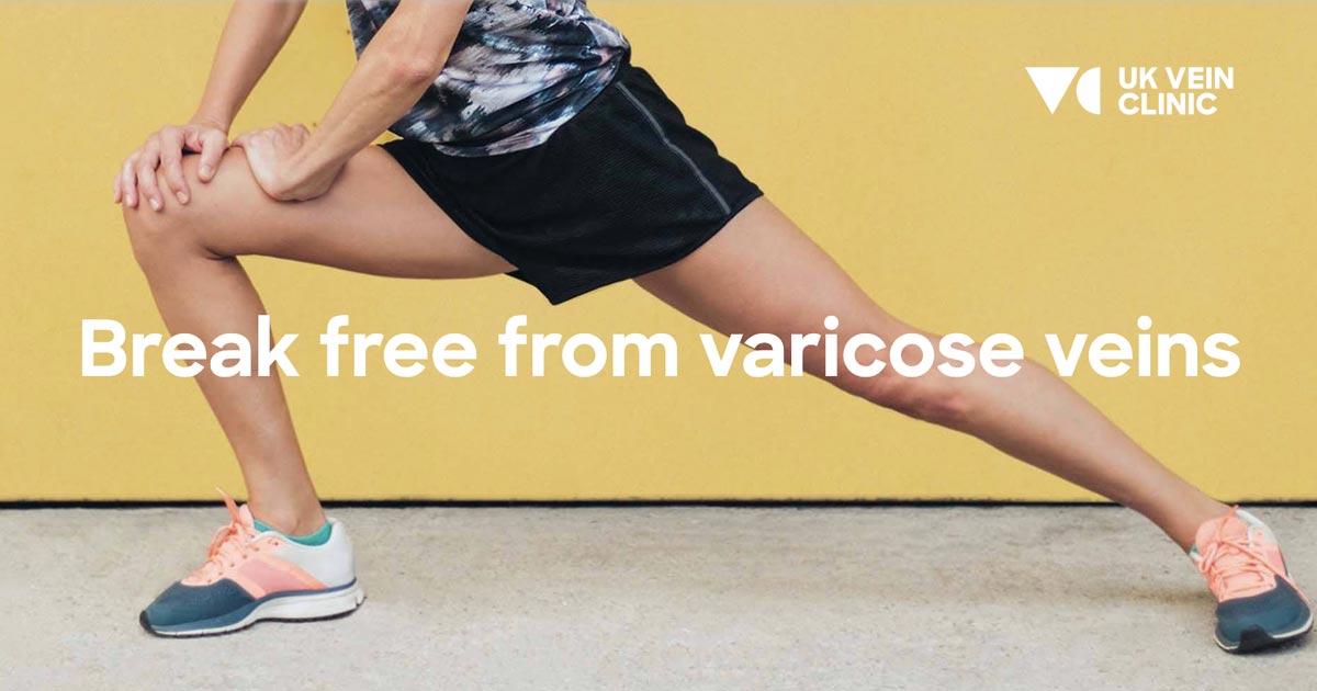 UK Vein Clinic London, Harley Street | Varicose & Thread Vein Removal