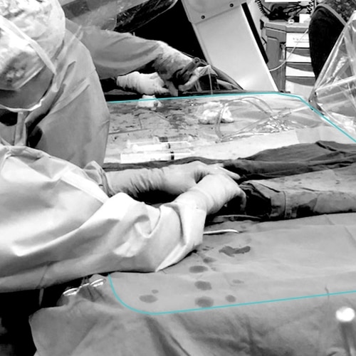 Retrograde IR Platform – Work surface for femoral access