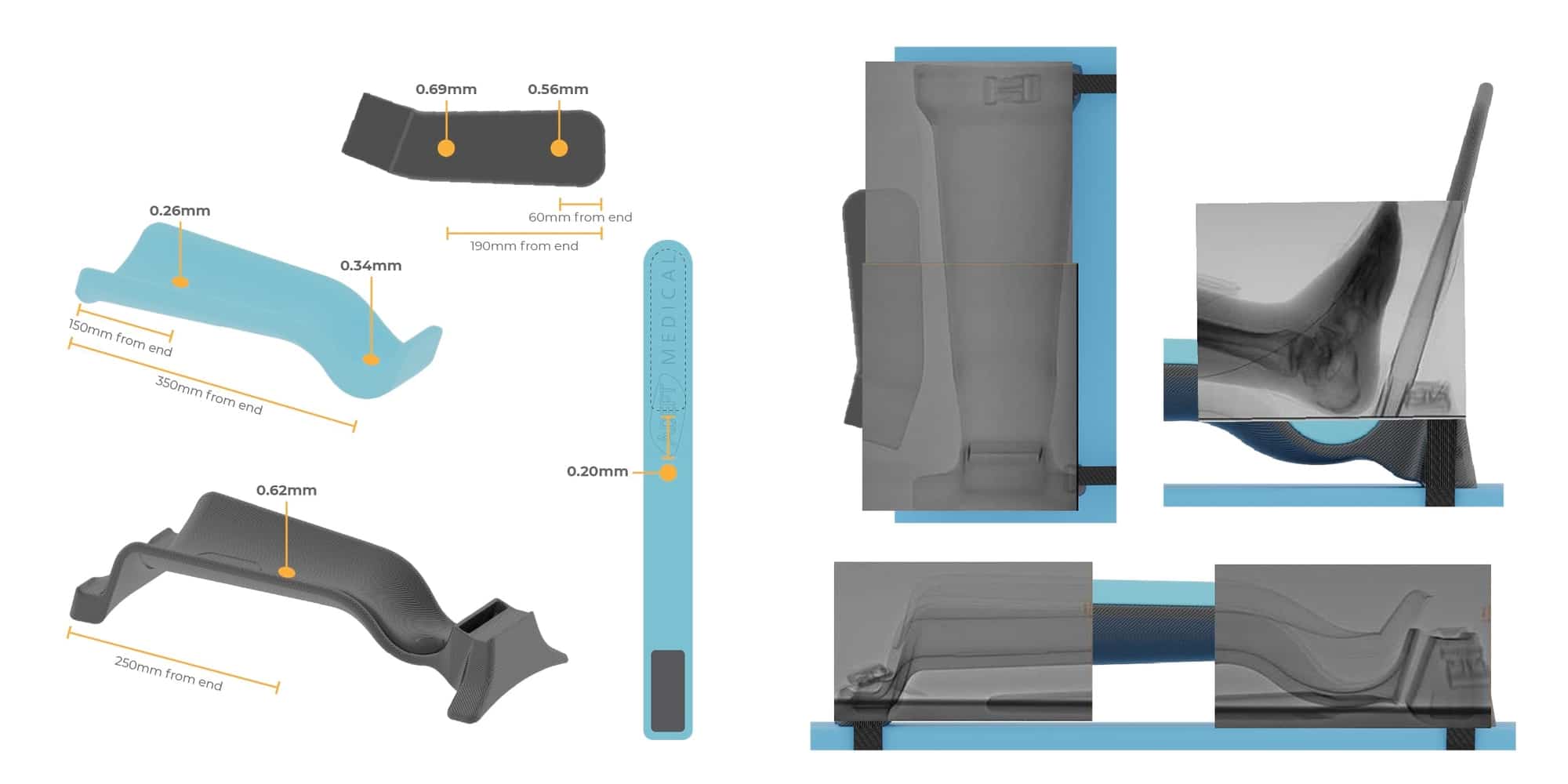 Lower Leg Support - Gentle immobilization, PAD procedure