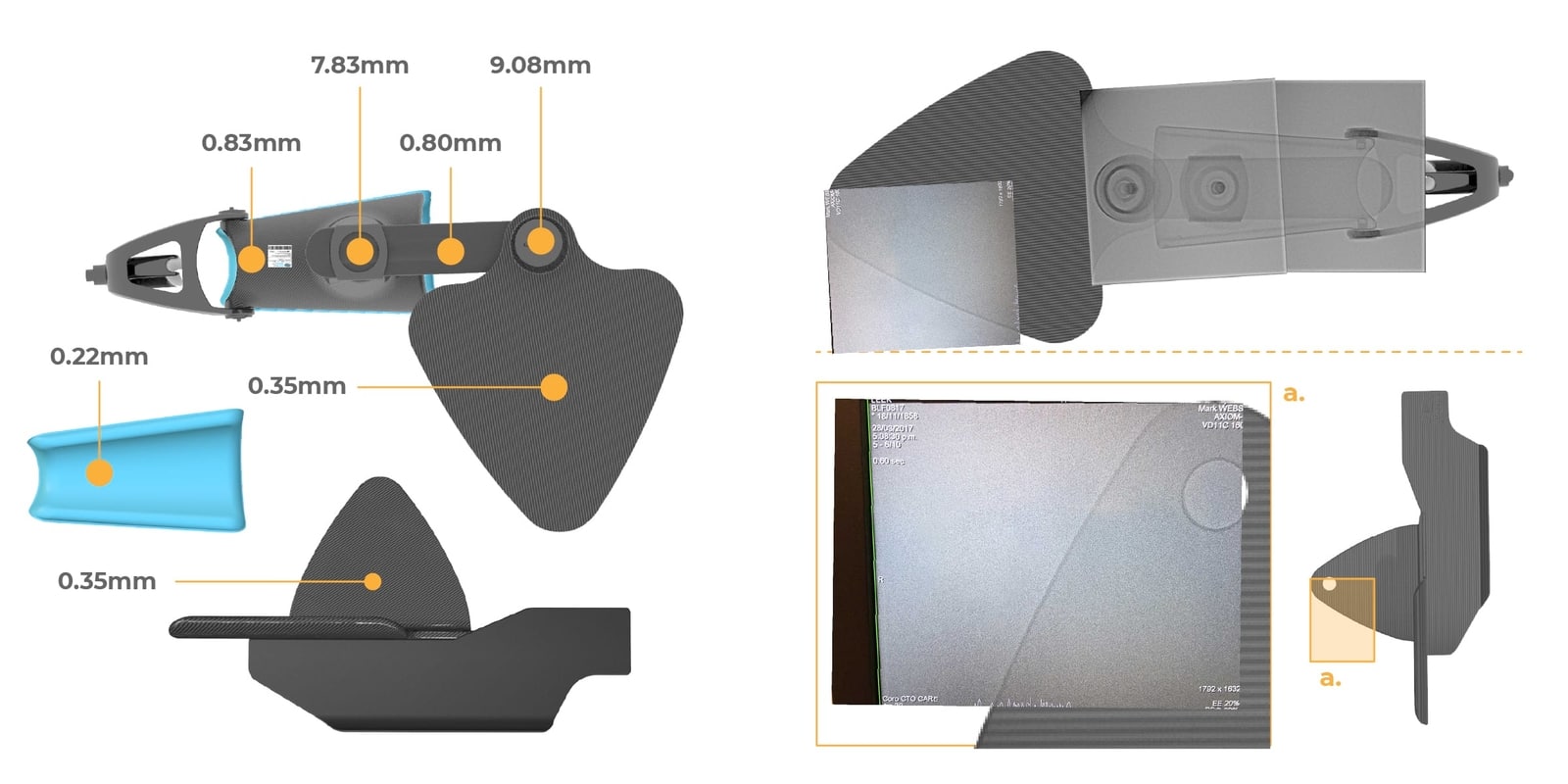 STARSystem - Radial Arm Board & Scatter Radiation Shield