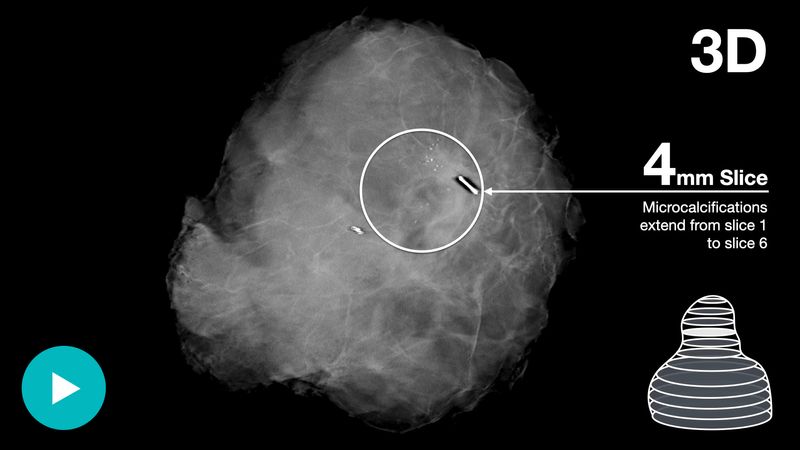The Mozart 3D Specimen Radiography System | KUBTEC