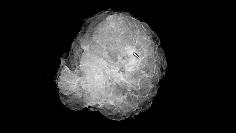 KUBTEC | Specimen Radiography Systems & Gamma Probes