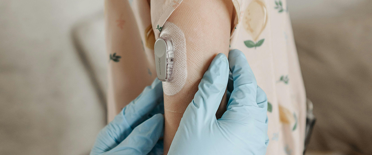 Explaining the CGMs Controversy