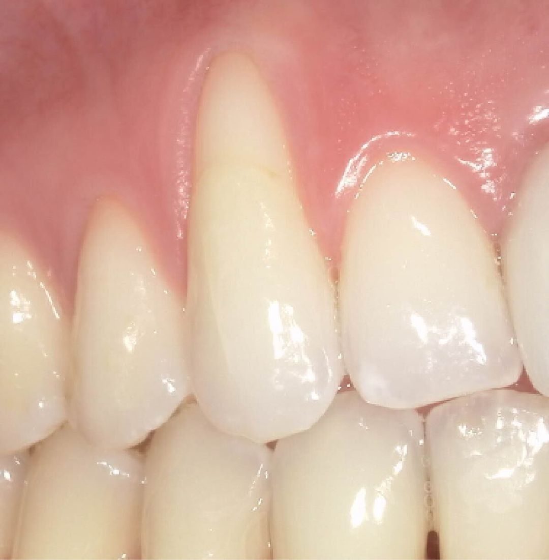 Edmonton Periodontist | Midtown Periodontics