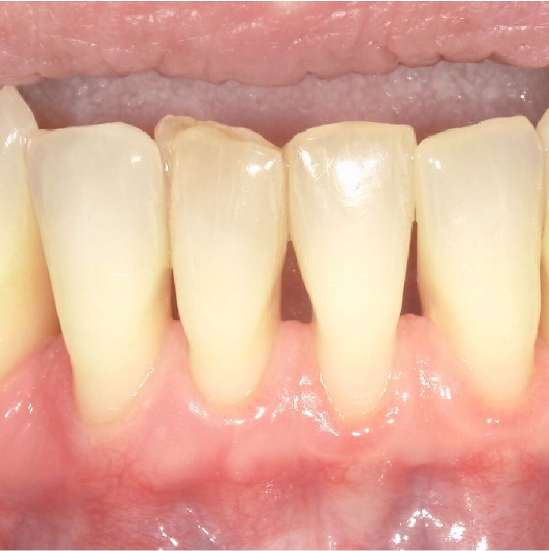 Edmonton Periodontist | Midtown Periodontics