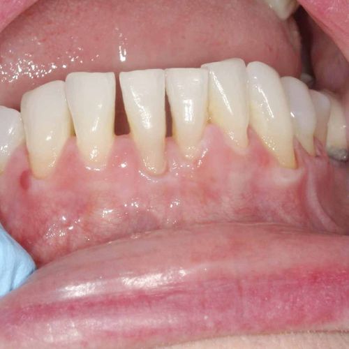 Edmonton Periodontist | Midtown Periodontics