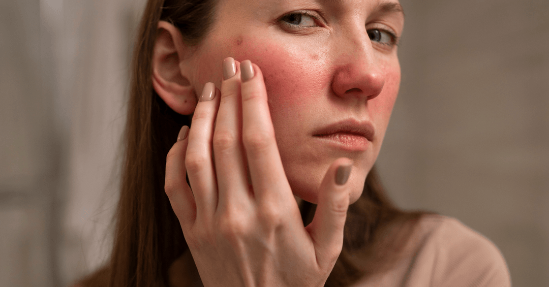 Perimenopause and Itchy Skin: Causes, Treatment, and Prevention ...