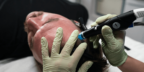 Combining Red Light Therapy and Hydrafacial Keravive Scalp Treatment ...