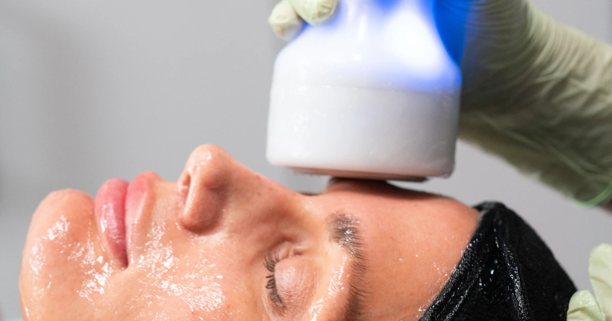 Neveskin™ Facial | Benefits and What to Expect