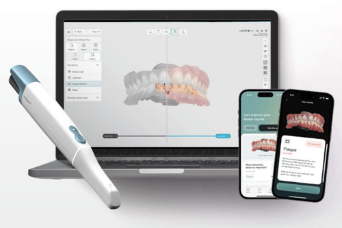 La CFAO dentaire : Guide complet