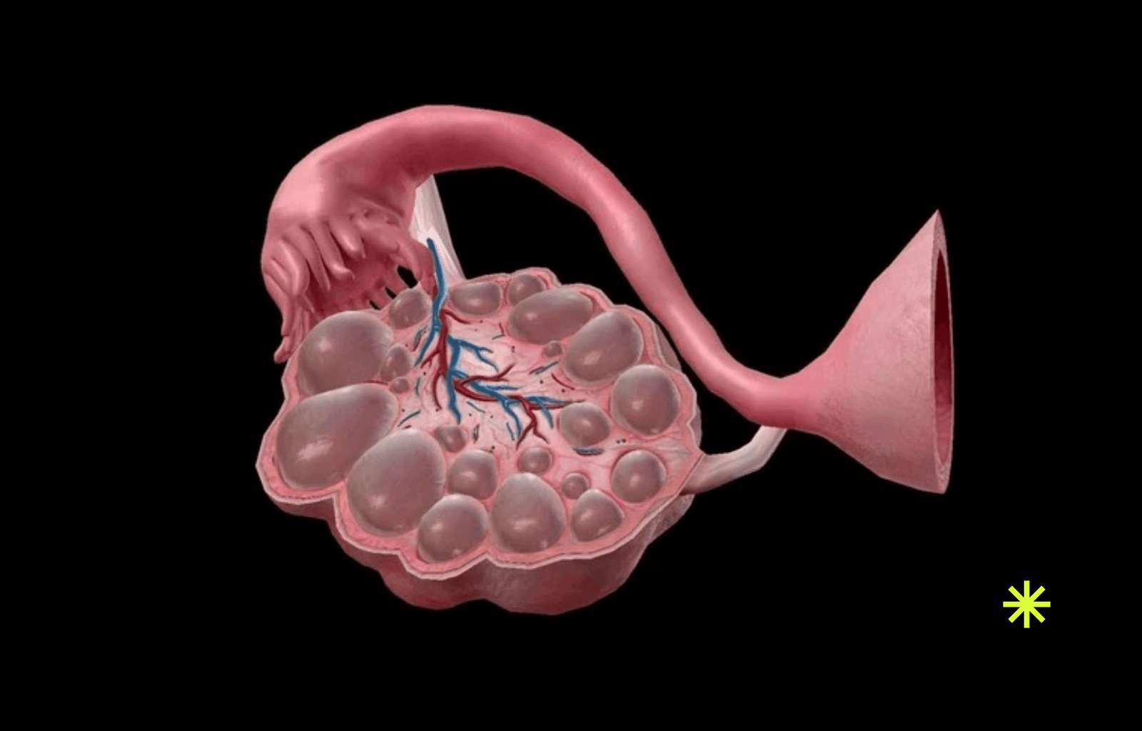 What is the biggest symptom of PCOS?