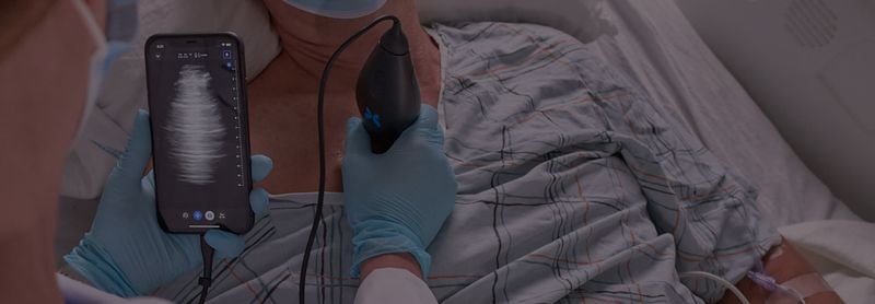 Butterfly Network | Point-of-care ultrasound solutions