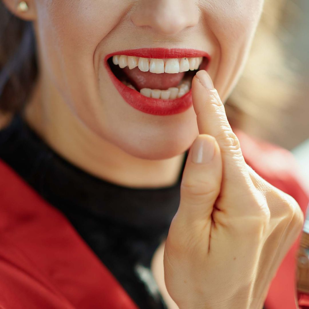 What is the Small Black Point on my Tooth?